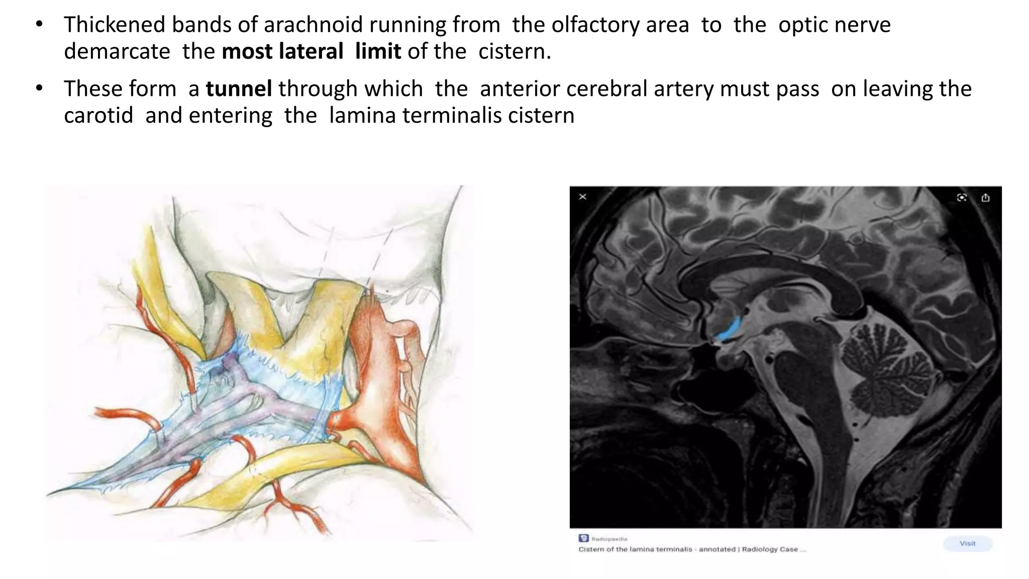 ANATOMY OF SUBARACHNOID CISTERNS OF BRAIN | PPTX