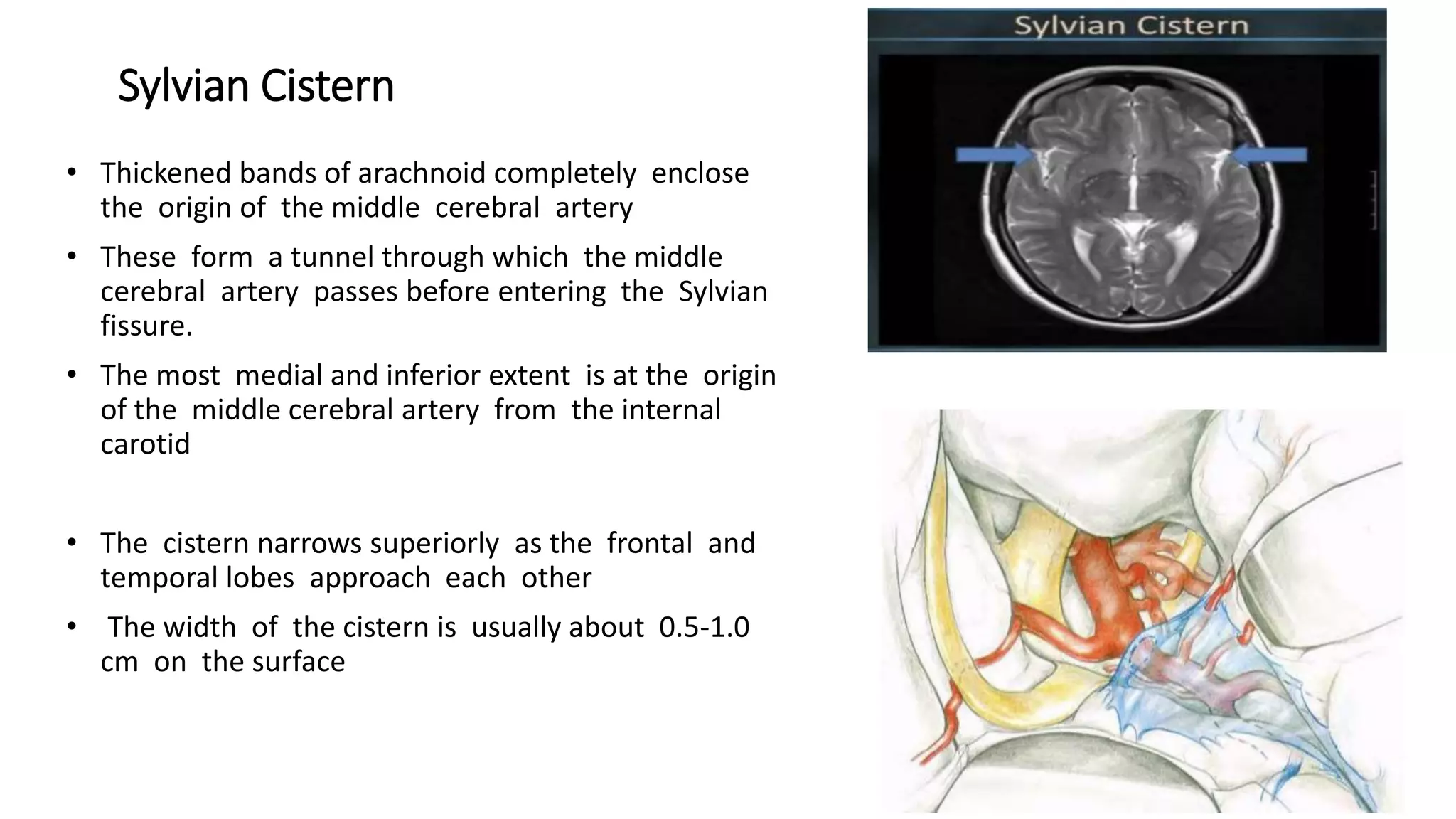 ANATOMY OF SUBARACHNOID CISTERNS OF BRAIN | PPTX