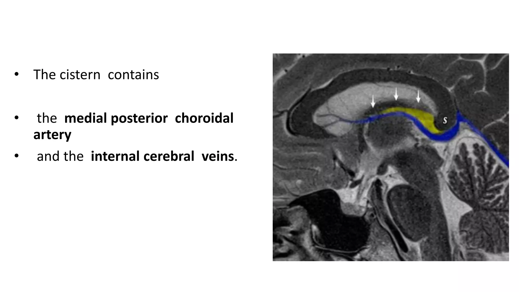 ANATOMY OF SUBARACHNOID CISTERNS OF BRAIN | PPTX