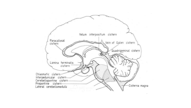 ANATOMY OF SUBARACHNOID CISTERNS OF BRAIN | PPTX