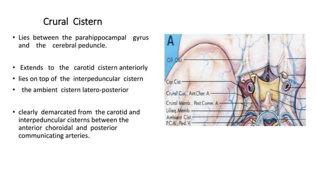 ANATOMY OF SUBARACHNOID CISTERNS OF BRAIN | PPTX