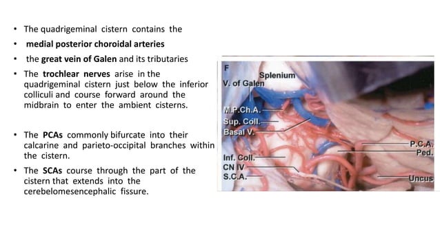 ANATOMY OF SUBARACHNOID CISTERNS OF BRAIN | PPTX
