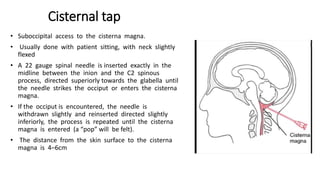 ANATOMY OF SUBARACHNOID CISTERNS OF BRAIN | PPT