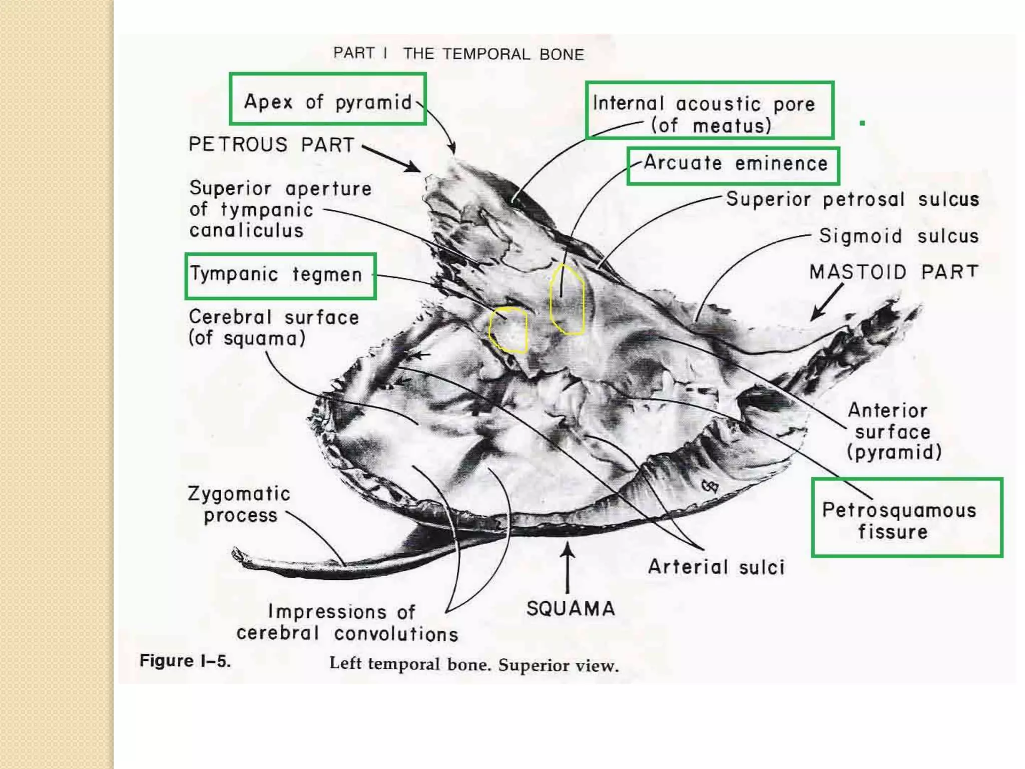 Anatomy of temporal bone By Dr.Vijay kumar , AMU | PPTX