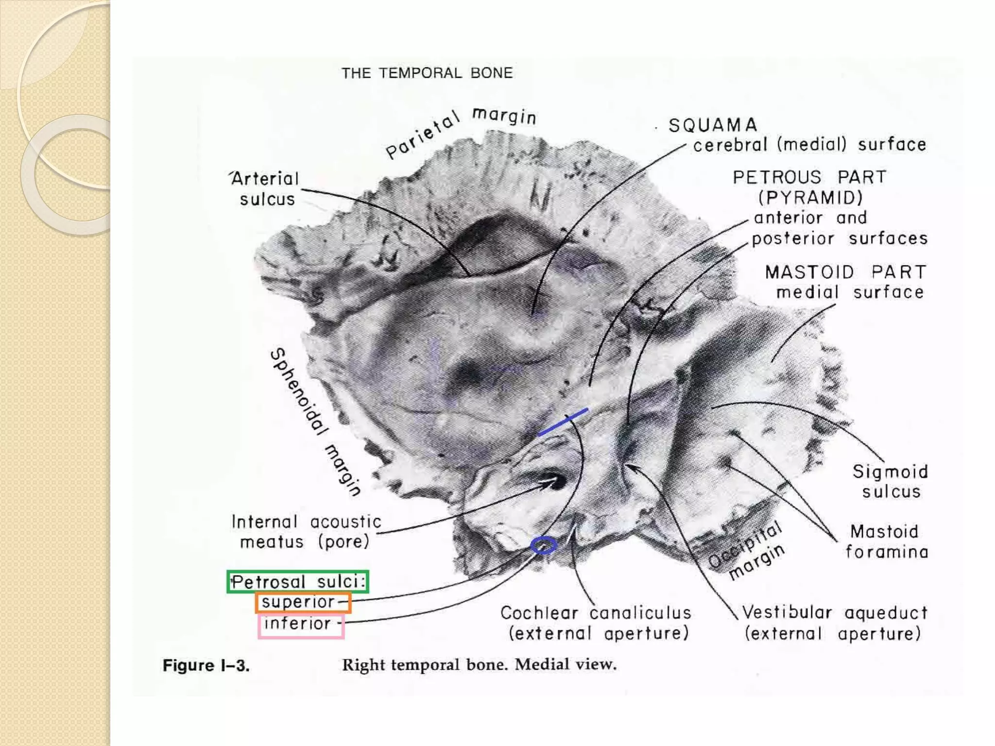 Anatomy of temporal bone By Dr.Vijay kumar , AMU | PPTX