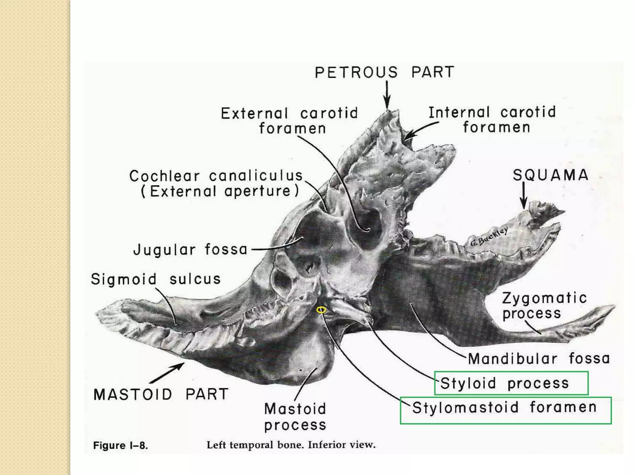 Anatomy of temporal bone By Dr.Vijay kumar , AMU | PPTX