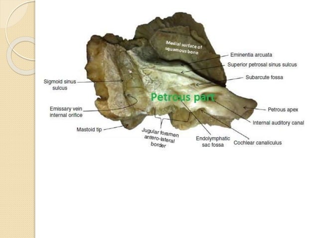 Anatomy of temporal bone By Dr.Vijay kumar , AMU | PPTX
