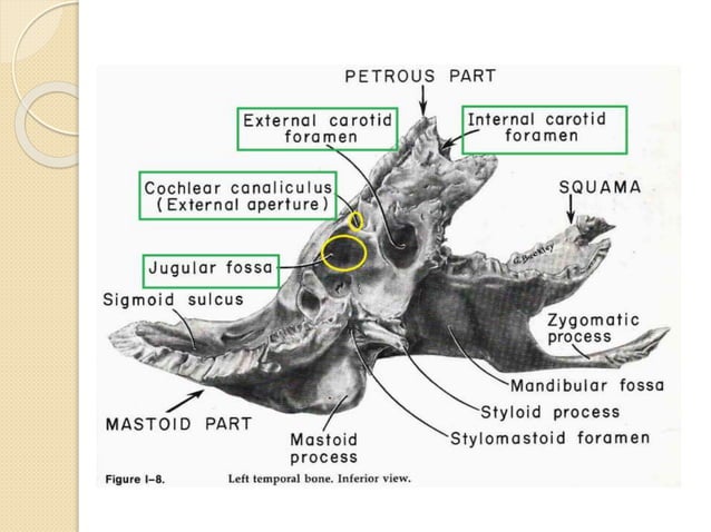 Anatomy of temporal bone By Dr.Vijay kumar , AMU | PPTX