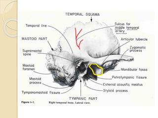 Anatomy of temporal bone By Dr.Vijay kumar , AMU | PPTX