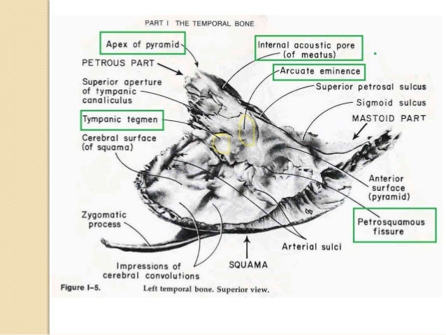 Anatomy of temporal bone By Dr.Vijay kumar , AMU