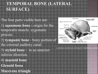 Temporal Bone Anatomy