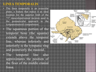 Temporal Line Skull