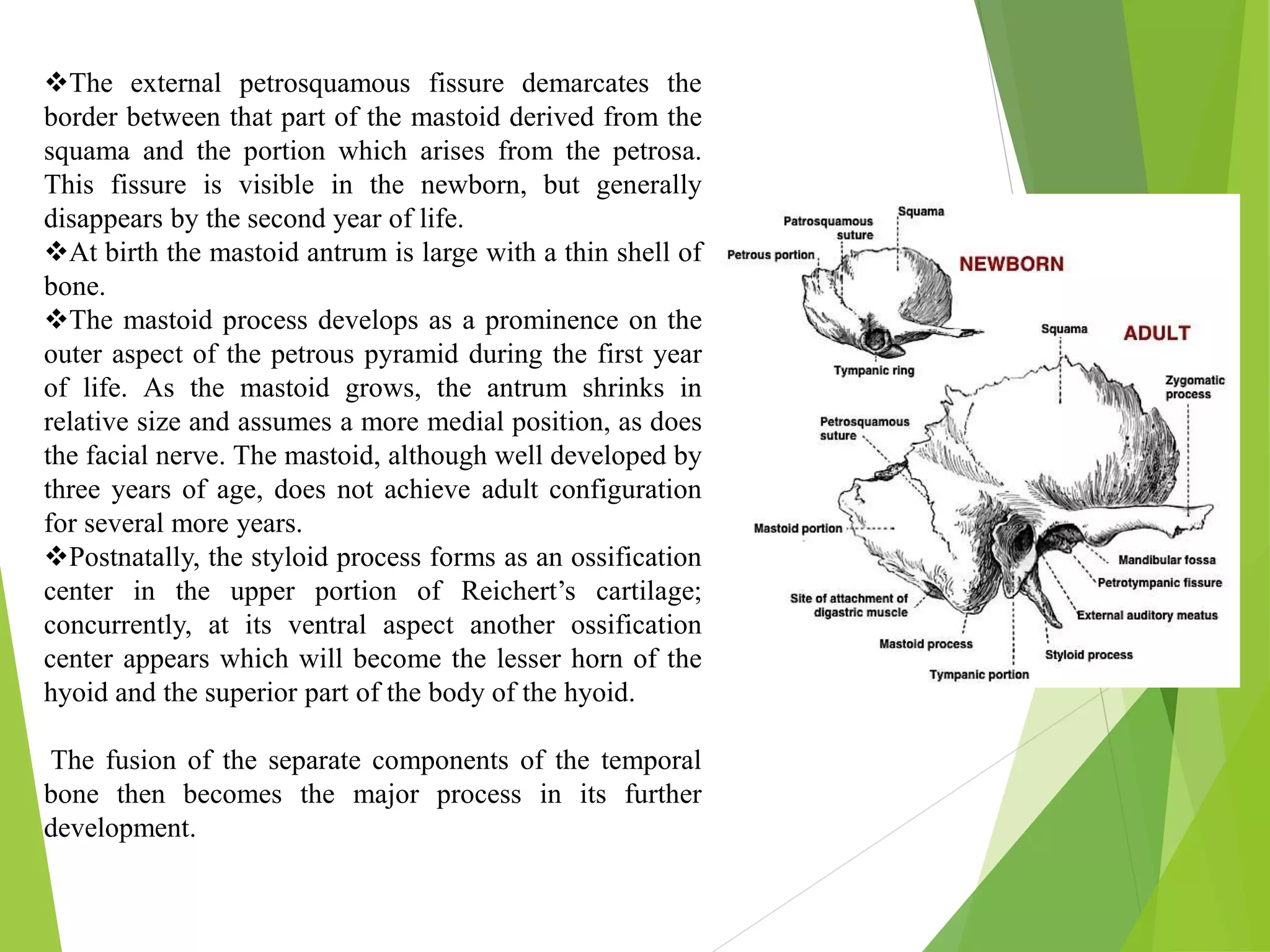 Anatomy of temporal bone and it’s surgical importance | PPTX