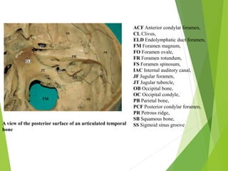 Anatomy of temporal bone and it’s surgical importance | PPTX