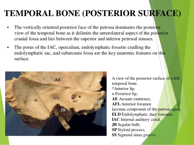 Surgical Anatomy Of Temporal Bone