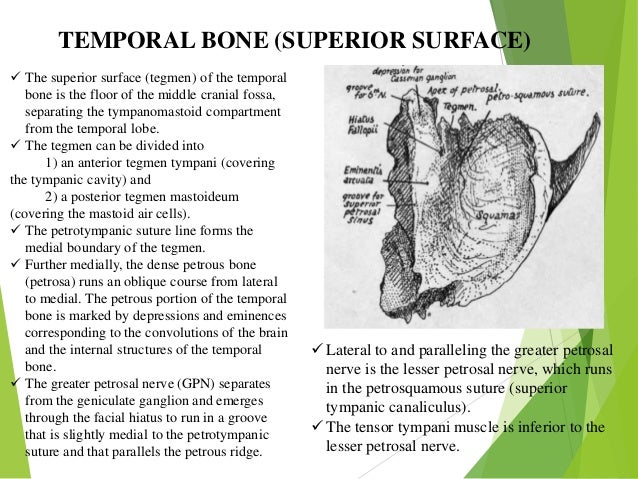 Surgical Anatomy Of Temporal Bone