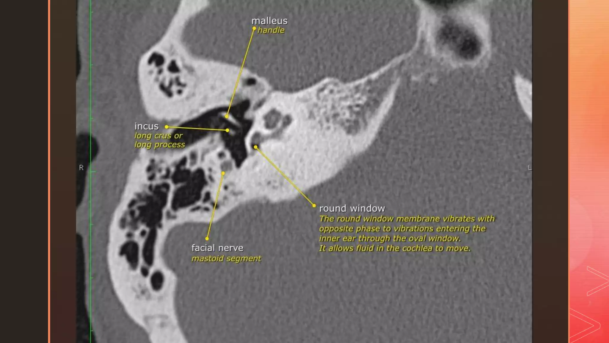 Anatomy of temporal bone final | PPTX