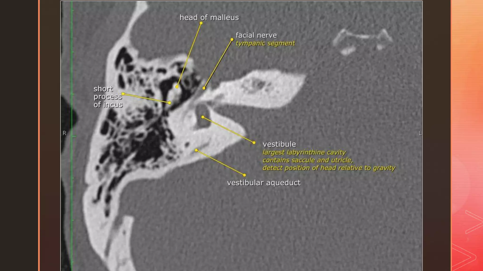 Anatomy of temporal bone final | PPTX