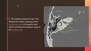 Anatomy of temporal bone final | PPTX