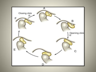 Anatomy of temporomandibular joint | PPTX
