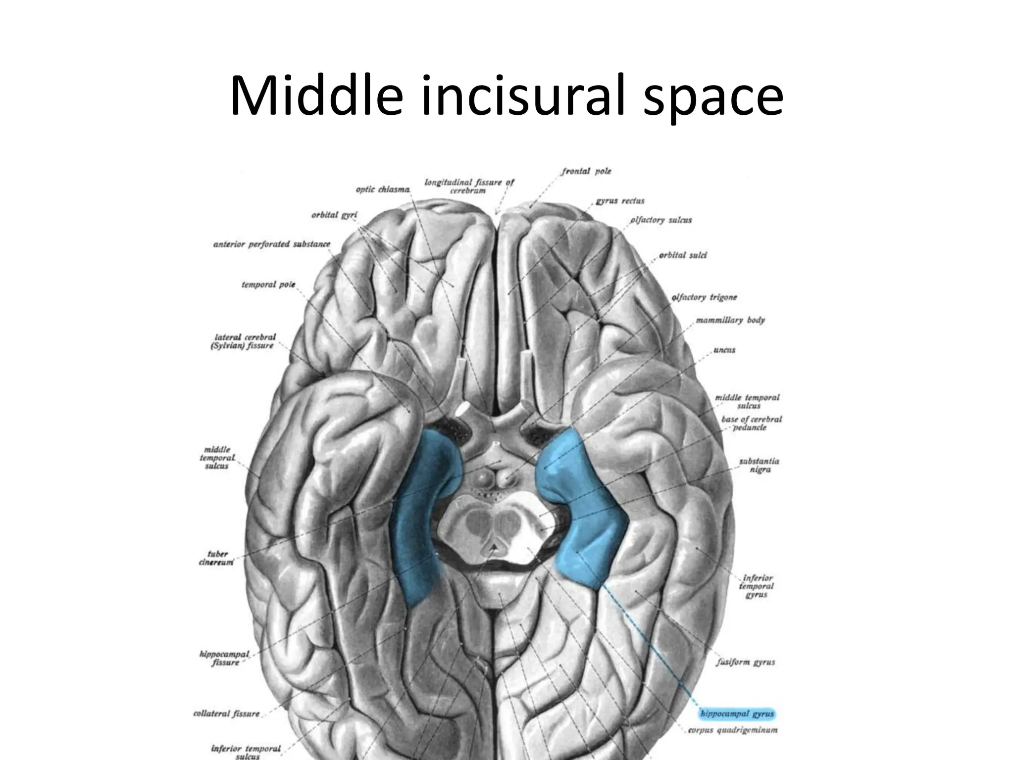ANATOMY OF TENTORIUM INCISURA | PPTX