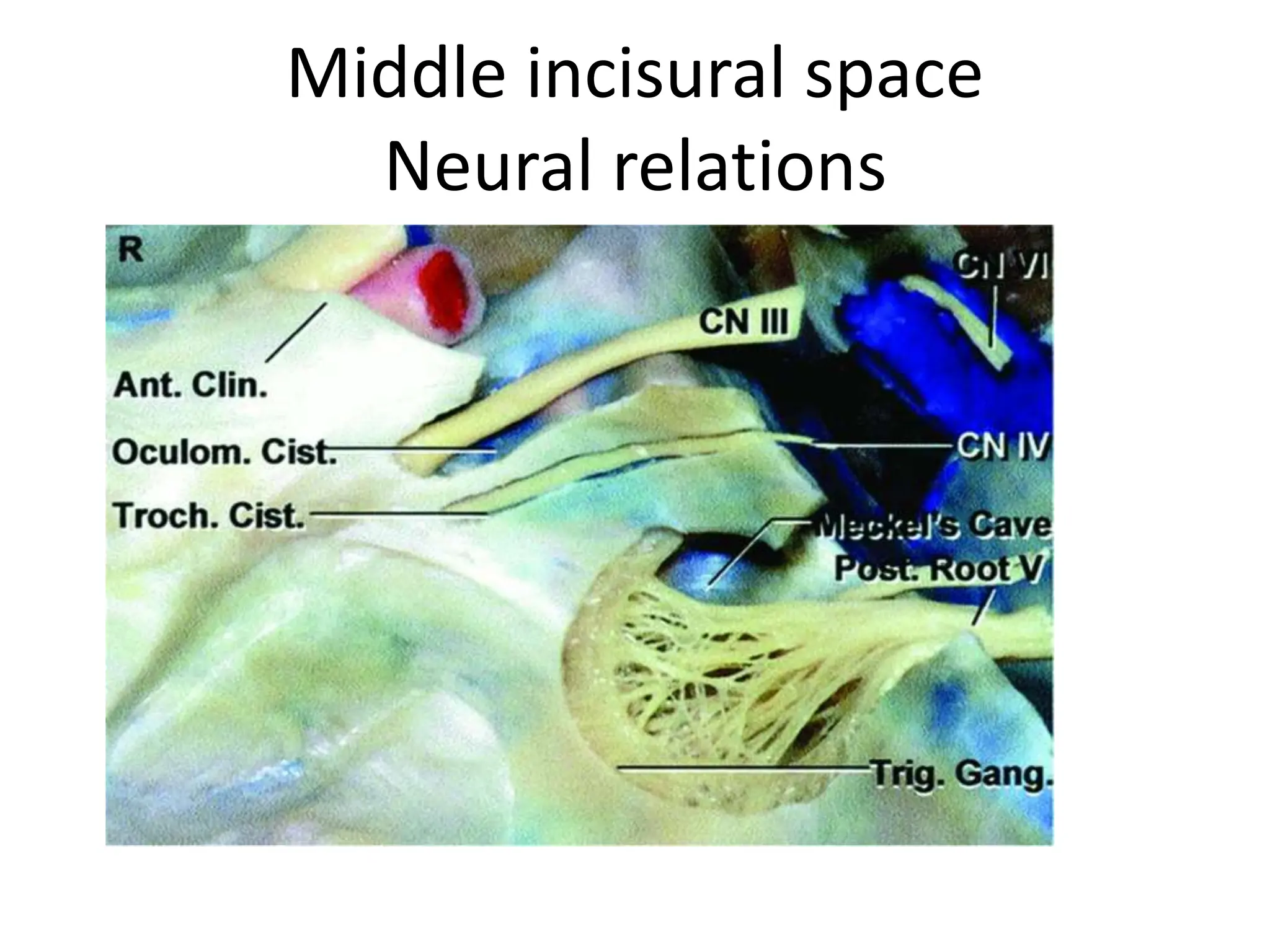 ANATOMY OF TENTORIUM INCISURA | PPTX
