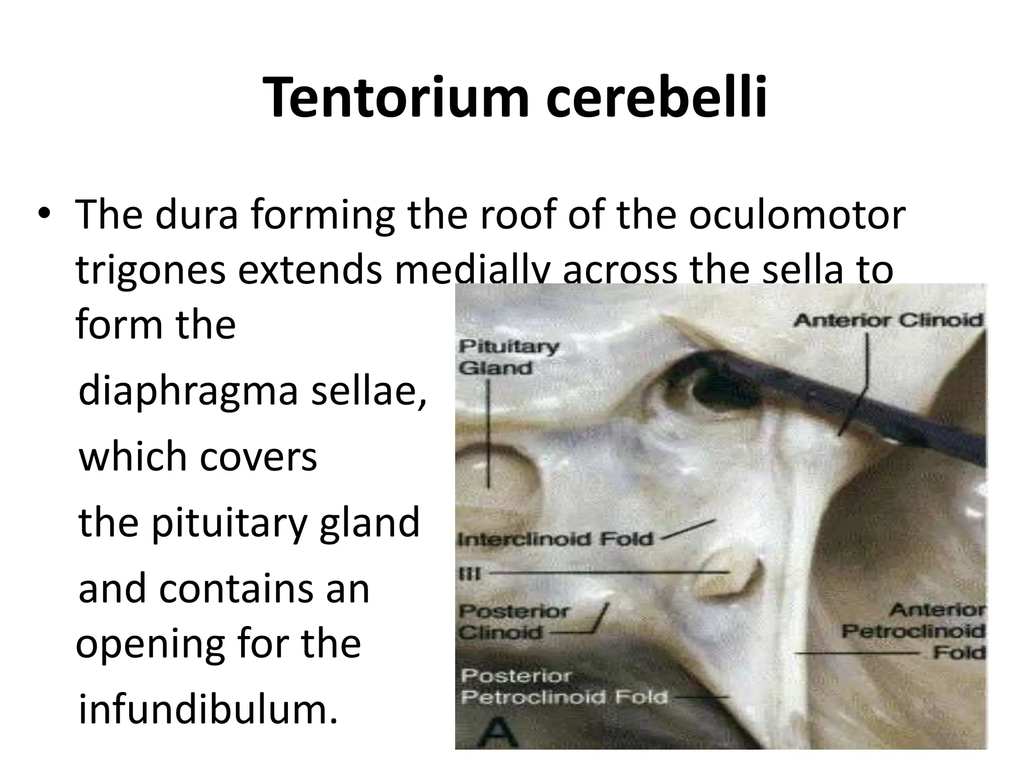 ANATOMY OF TENTORIUM INCISURA | PPTX