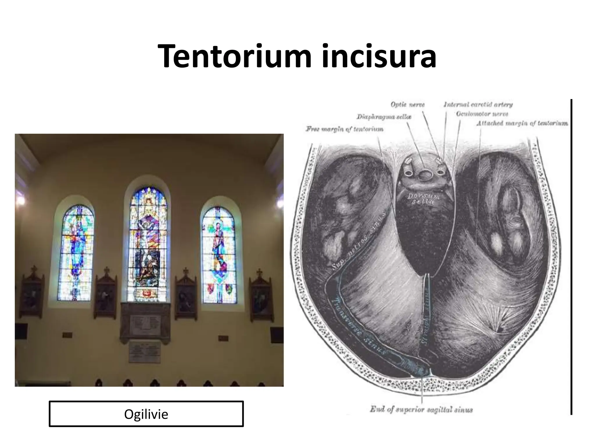 ANATOMY OF TENTORIUM INCISURA | PPTX
