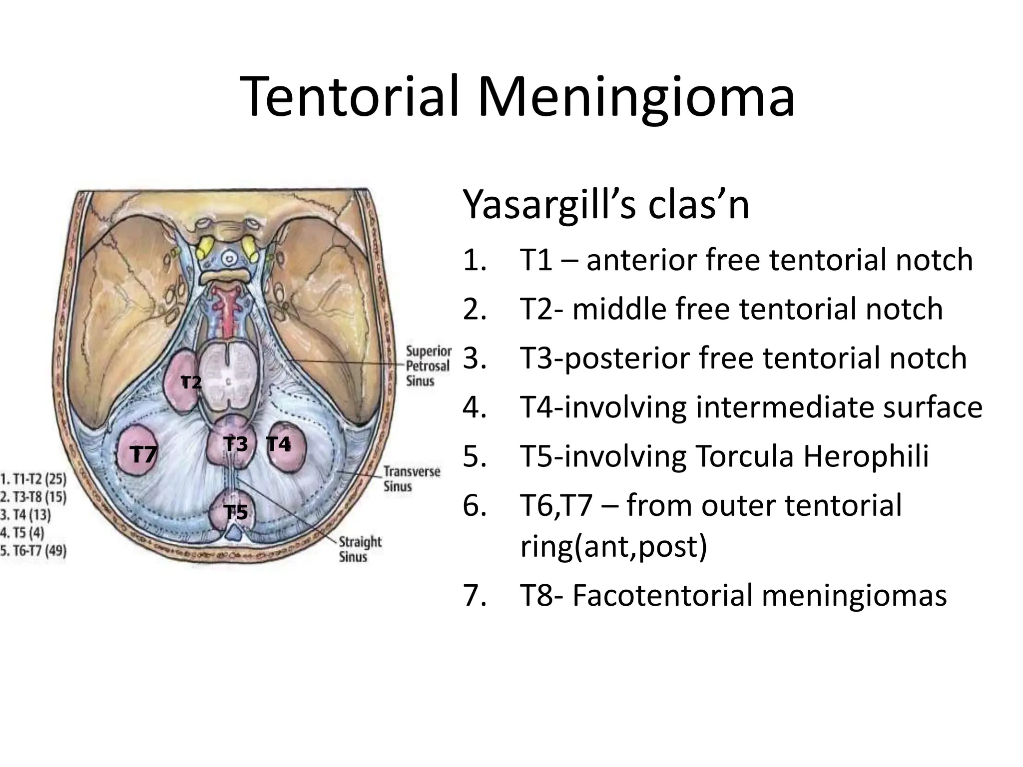 ANATOMY OF TENTORIUM INCISURA | PPTX