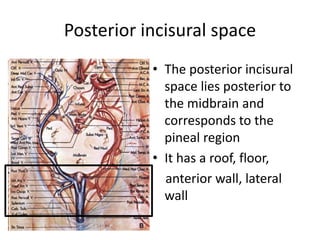ANATOMY OF TENTORIUM INCISURA | PPTX
