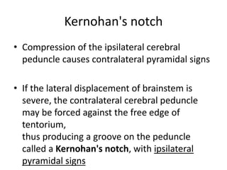 ANATOMY OF TENTORIUM INCISURA | PPTX