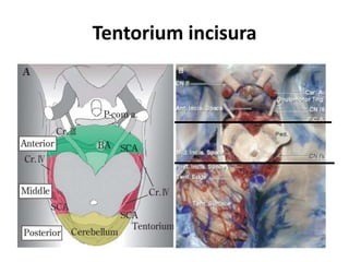 ANATOMY OF TENTORIUM INCISURA | PPTX