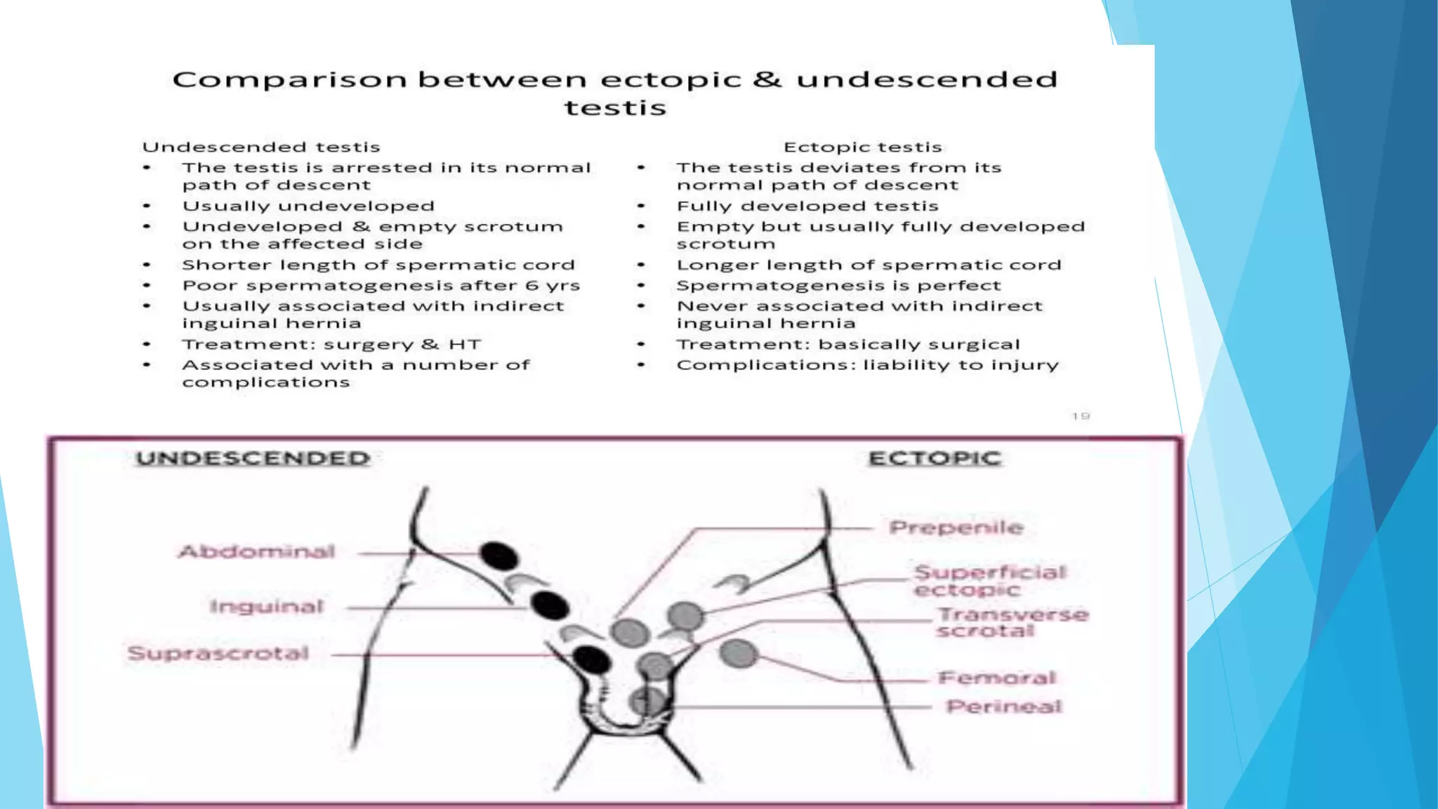 Anatomy of testis | PPTX