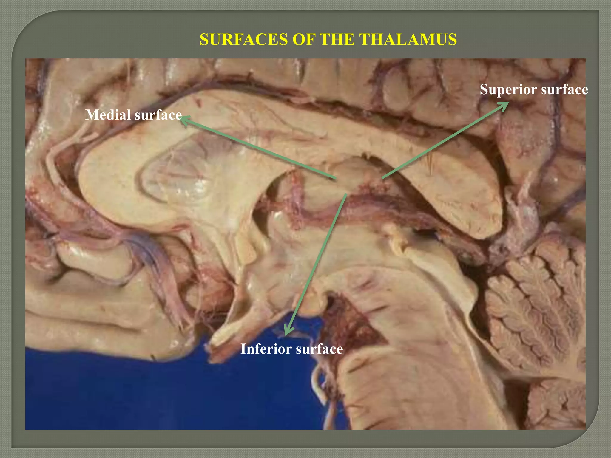 Anatomy of THALAMUS.pptx