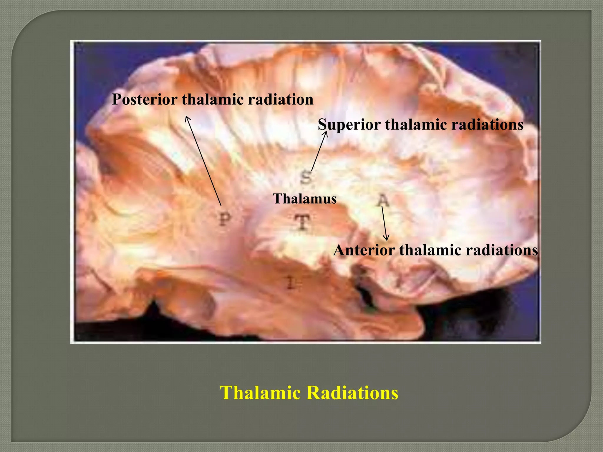 Anatomy of THALAMUS.pptx