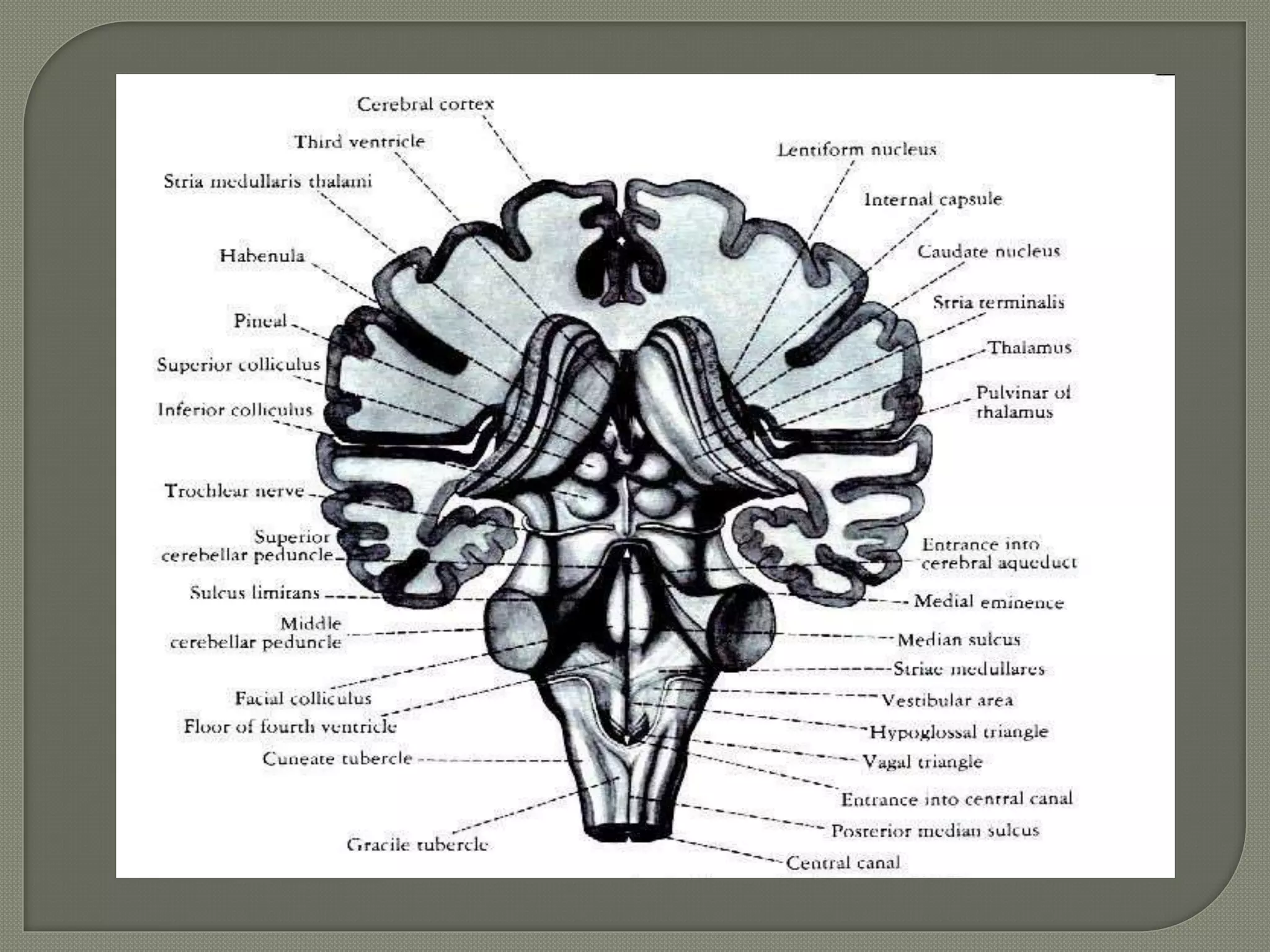 Anatomy of THALAMUS.pptx