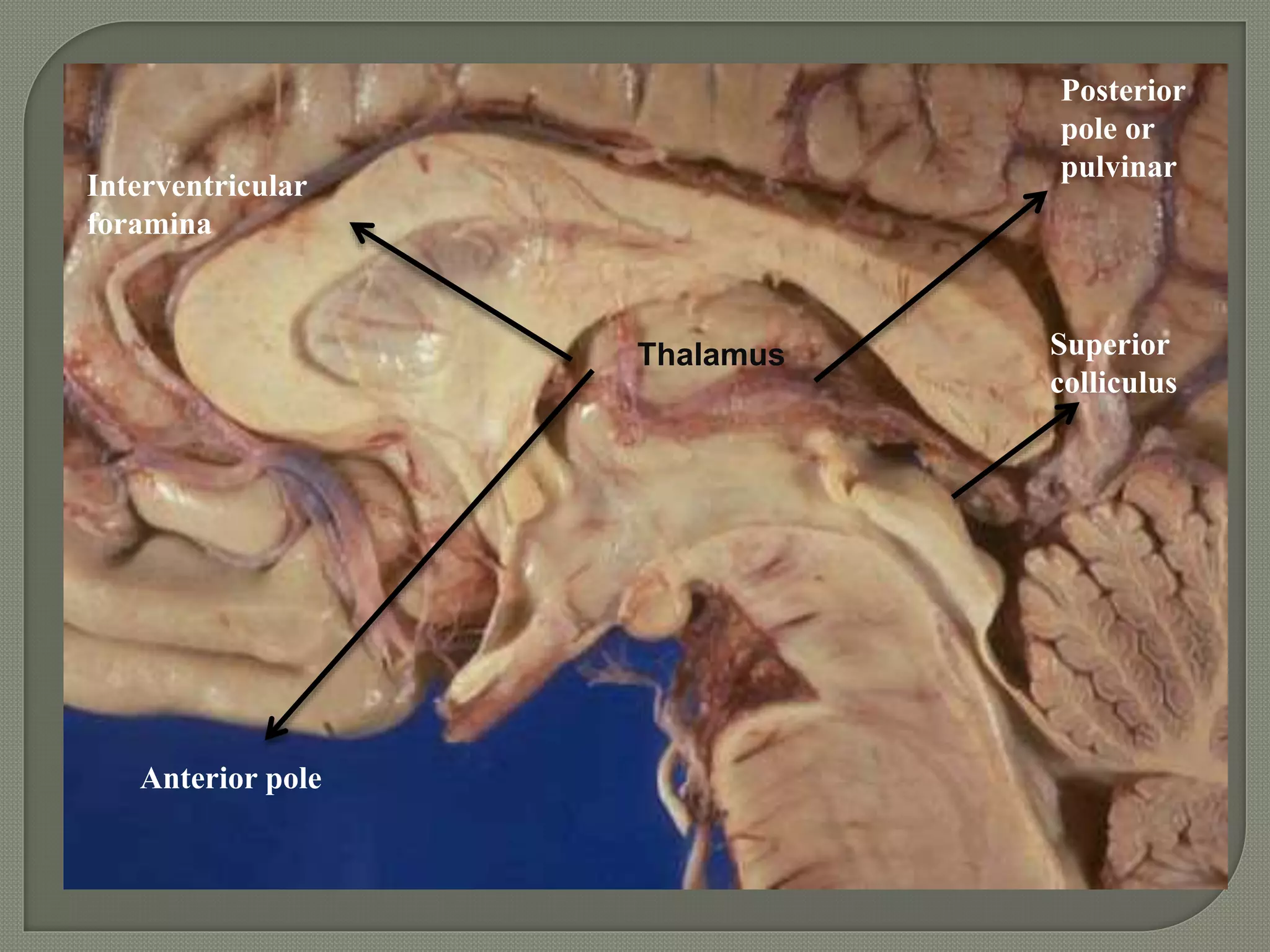 Anatomy of THALAMUS.pptx