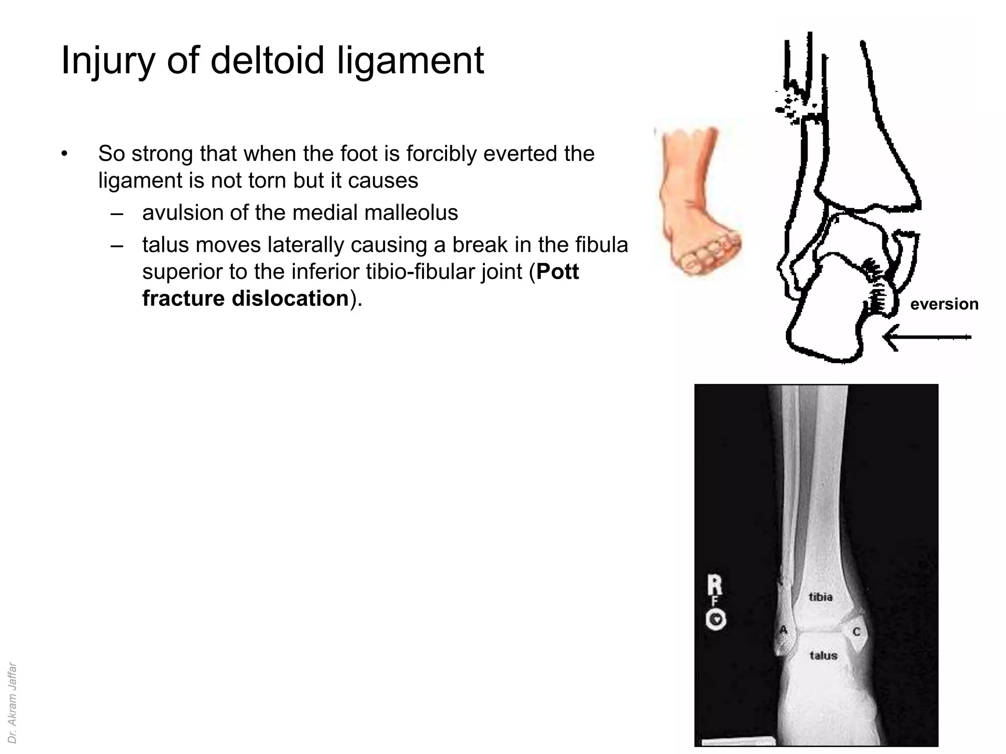Anatomy of the ankle and joints of foot | PPTX