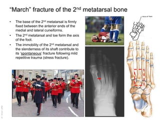 Anatomy of the ankle and joints of foot | PPTX