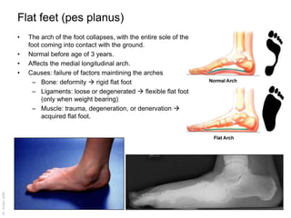 Anatomy of the ankle and joints of foot | PPTX