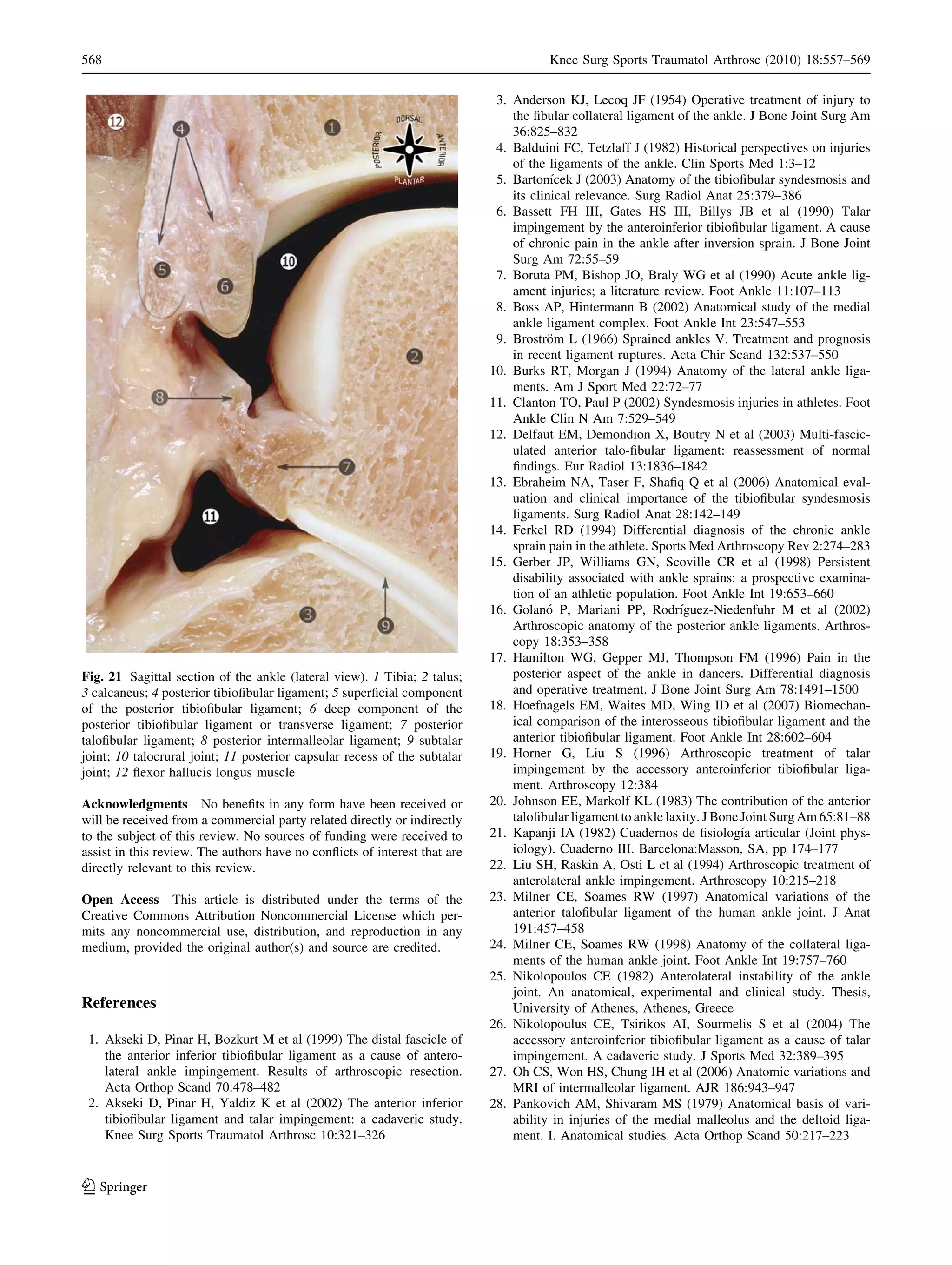Anatomy of the ankle ligaments a pictorial essay | PDF