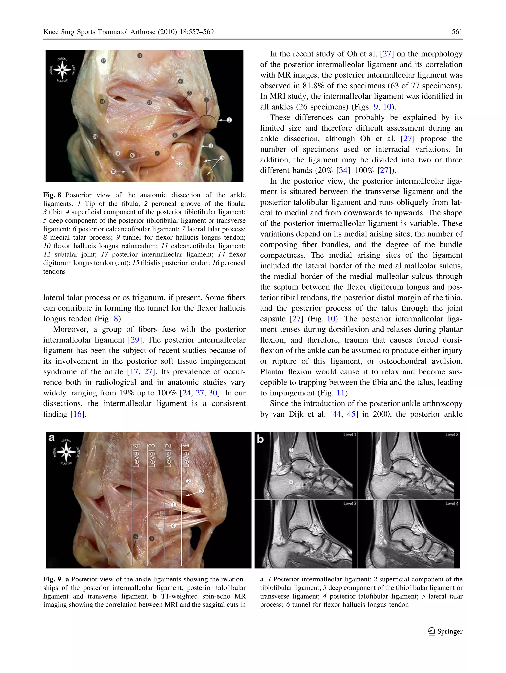 Anatomy of the ankle ligaments a pictorial essay | PDF