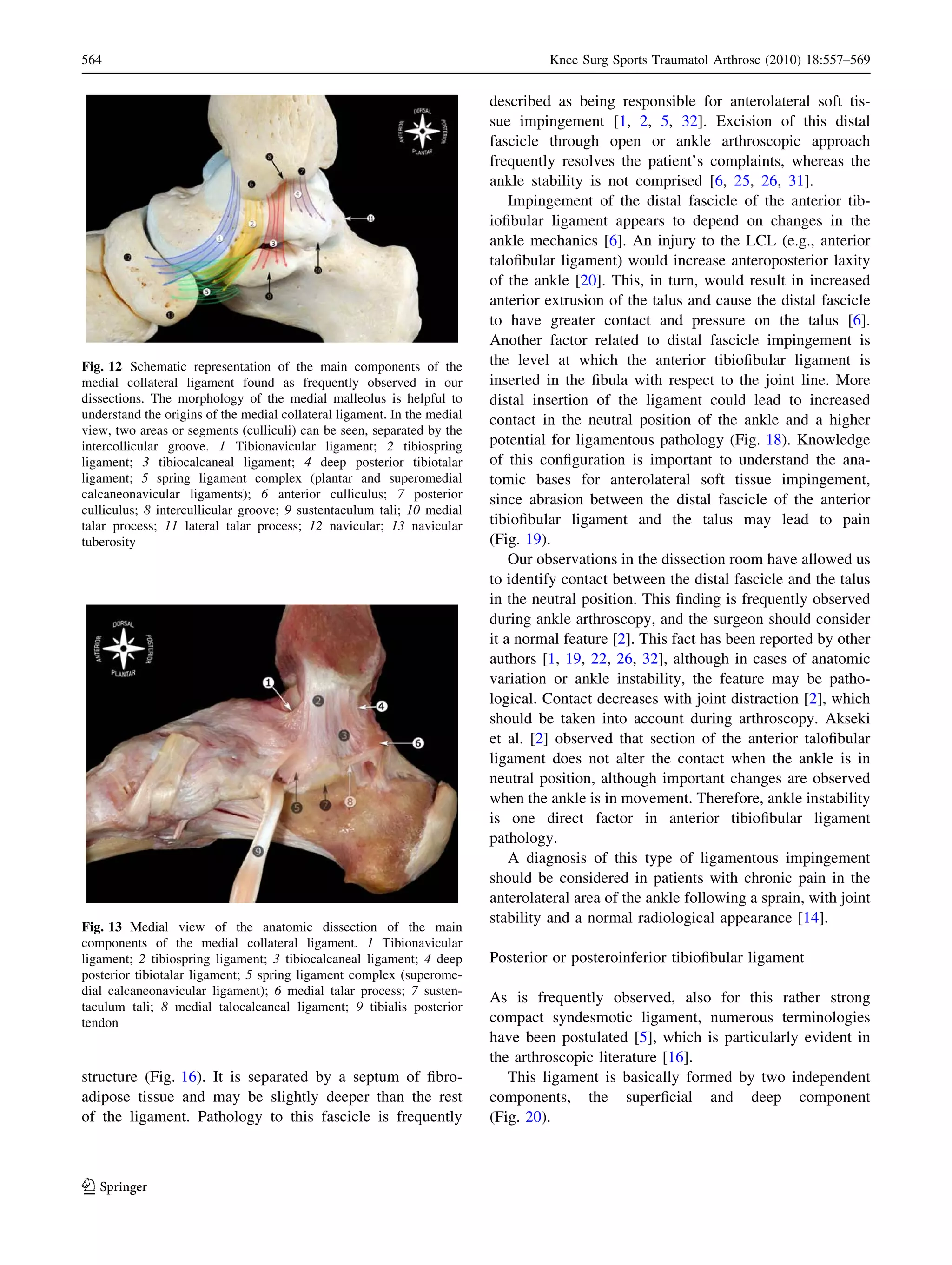 Anatomy of the ankle ligaments a pictorial essay | PDF