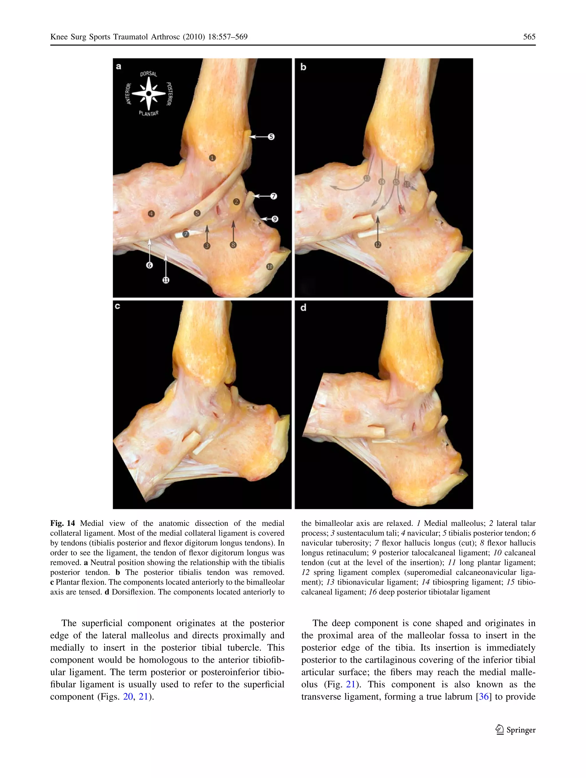 Anatomy of the ankle ligaments a pictorial essay | PDF