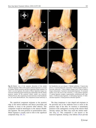 Anatomy of the ankle ligaments a pictorial essay | PDF
