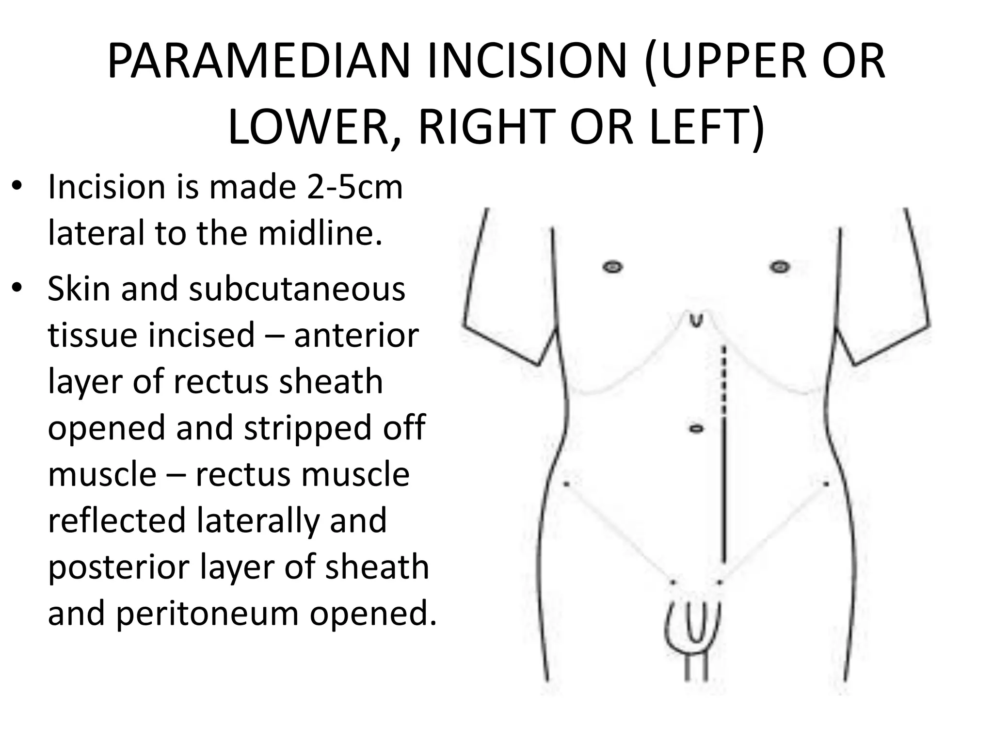 Anatomy of the anterior abdominal wall and incisions | PPTX
