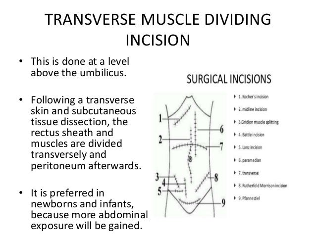 Anatomy of the anterior abdominal wall and incisions