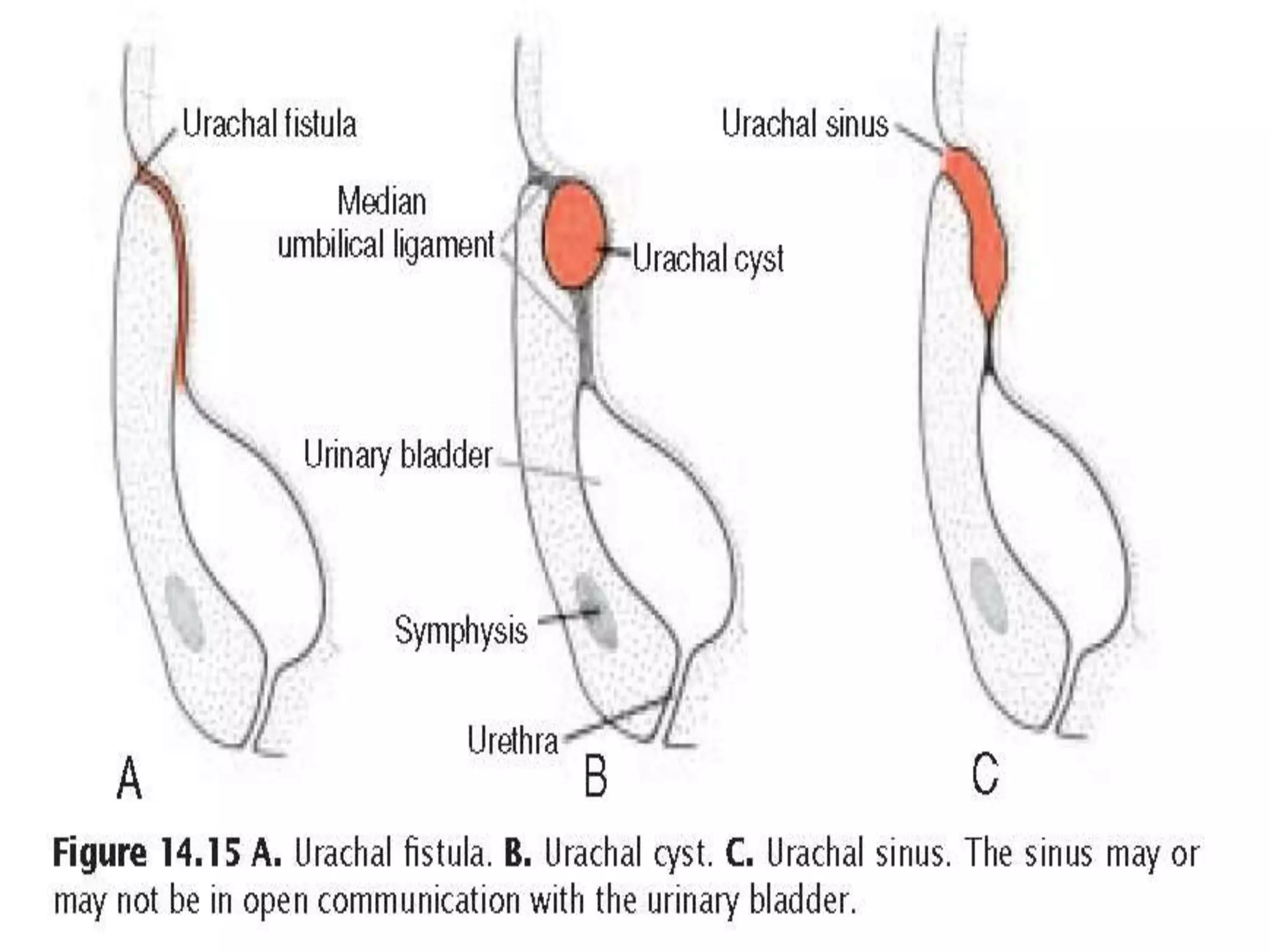 anatomy of the bladder.ppt