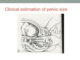 Anatomy of the Bony Pelvis: A Study In Android Structure | PPT