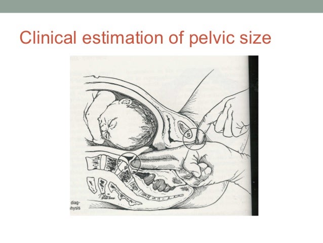Anatomy of the Bony Pelvis: A Study In Android Structure